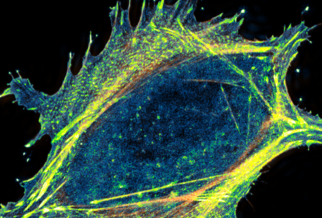 Finnish Advanced Microscopy Node – Open-access imaging and microscopy services in Helsinki ...